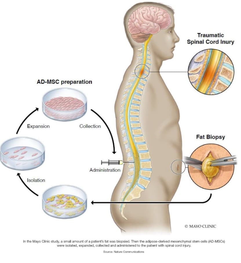 stem cell processes
