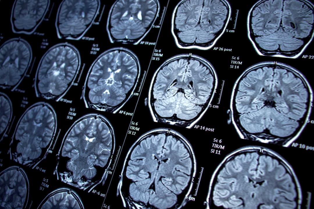 Topics | Health & Medicine | 1440